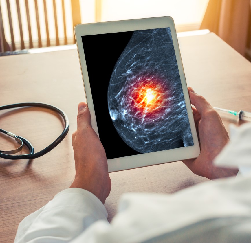 Artificial intelligence discovers new antibiotic candidate | CIDRAP Artificial intelligence discovers new antibiotic candidate | CIDRAP